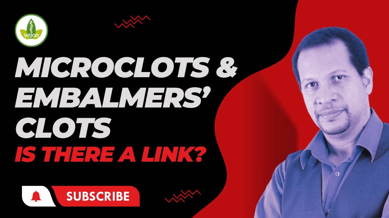 Coffee Ground Clots noted by Embalmers. Microclots?? - McMillan ...