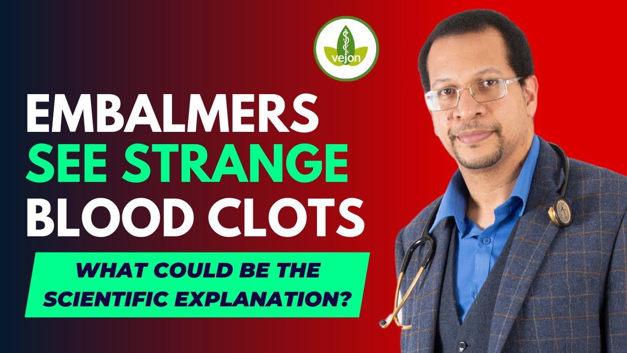 Scientific explanation for strange embalmers' clots. Is it serious ...