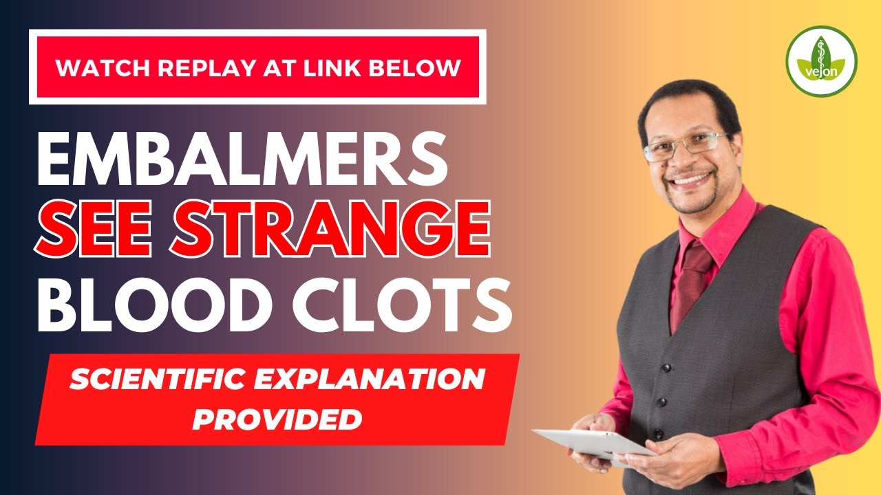 The potential link between serum Cryoglobulins and Embalmers Clots ...